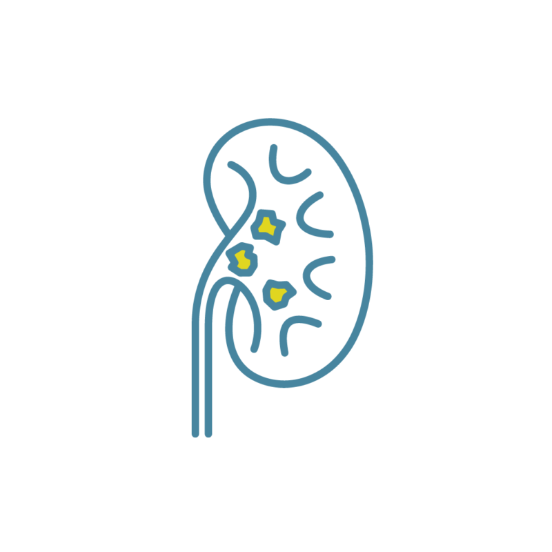 Varicocele - Dr. Oswaldo Islas García